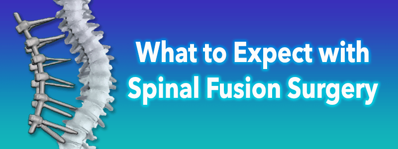 What to Expect with Spinal Fusion Surgery - Scoliosis Care Centers