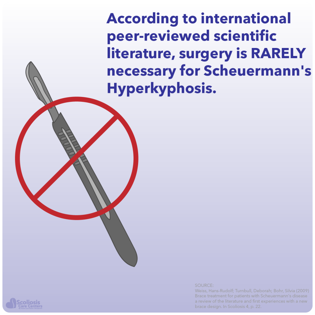 Kyphosis and Hyperkyphosis - What it is, how it happens, and what to do