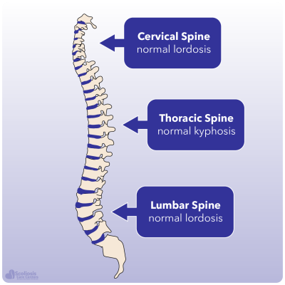 Kyphosis and Hyperkyphosis - What it is, how it happens, and what to do