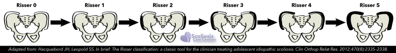 Risser Signs, Skeletal Age, and Scoliosis: How are they related?